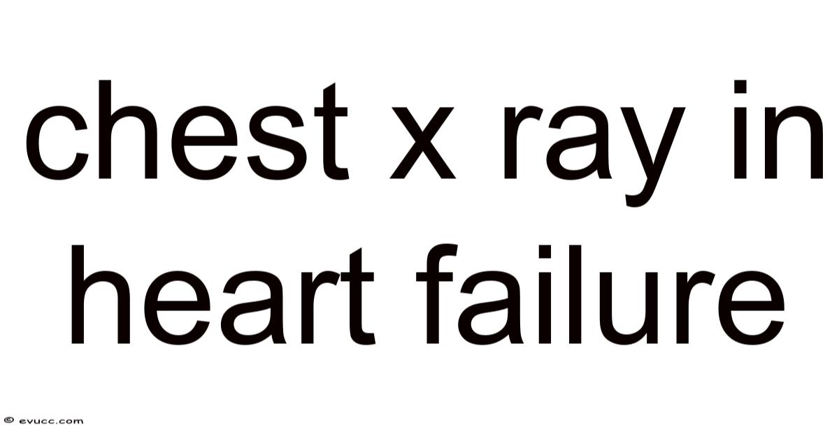 Chest X Ray In Heart Failure